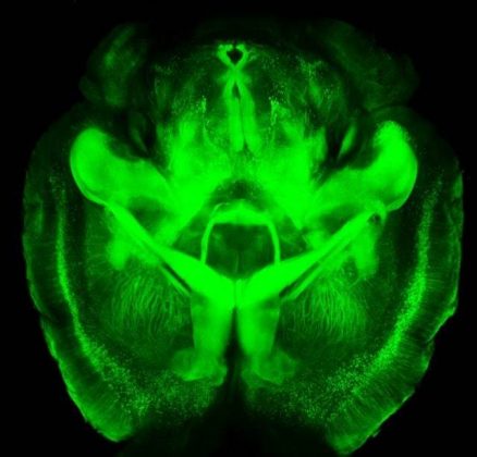 CLARITY el método que nos permite observar el cerebro como gelatina ...