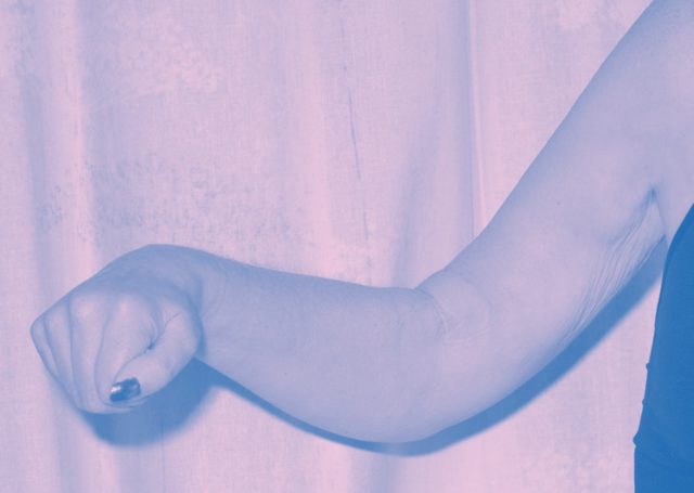 Distonía: tipos, causas, síntomas y características | Psyciencia